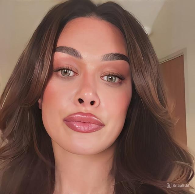 Amani Jlassi flies to Turkey to have more plastic surgery – Daily News